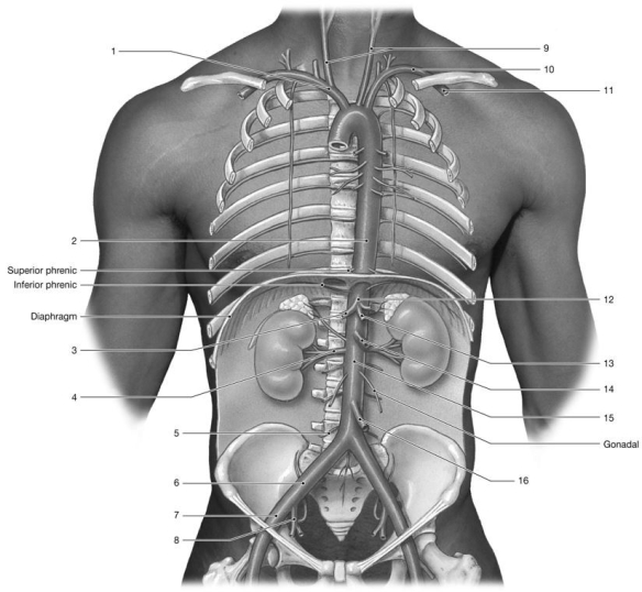 Figure 19-2 -Identify the Artery Labeled Figure 19-2 -Identify the Artery Labeled